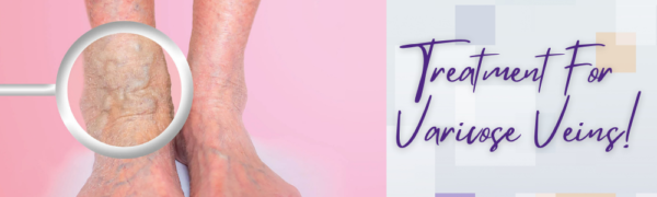 Understanding the Nature of Varicose Veins - Bond Clinic, P.A. Bond ...